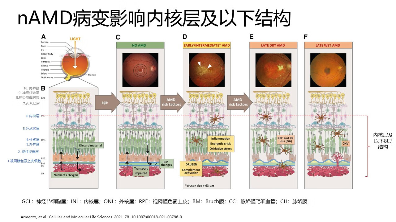 nAMD疾病再认识-京东健康